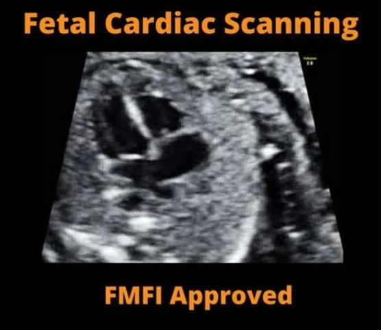 Fetal Anomaly Scan | Dubai Gynaecology Clinic