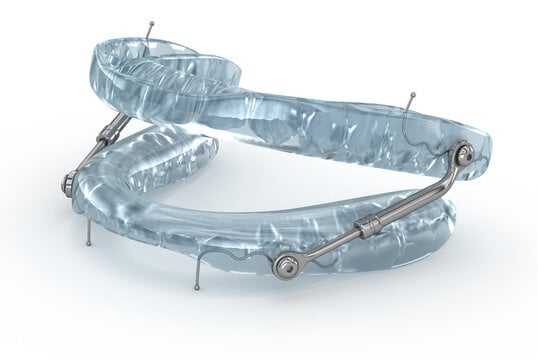 Mandibular Advancement Devices Dubai (Snoring & Sleep Apnea Treatment)