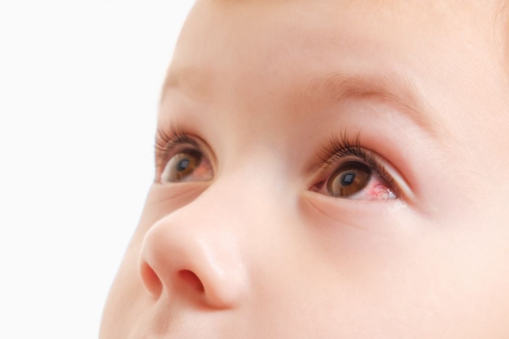 Pediatric Glaucoma Treatment | Ophthalmology Clinic in Dubai DRHC