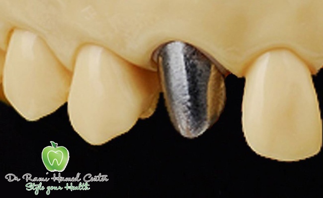 Dental Clinic in Dubai | Cosmetic Dentistry | Prosthodontist