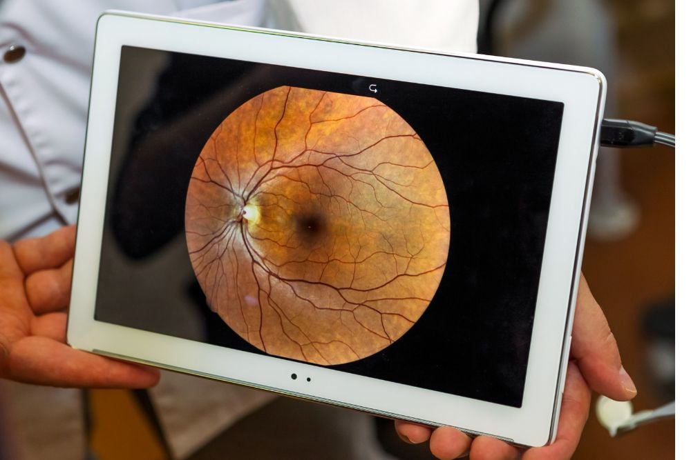 Retina Treatment | Ophthalmology Clinic in Dubai DRHC