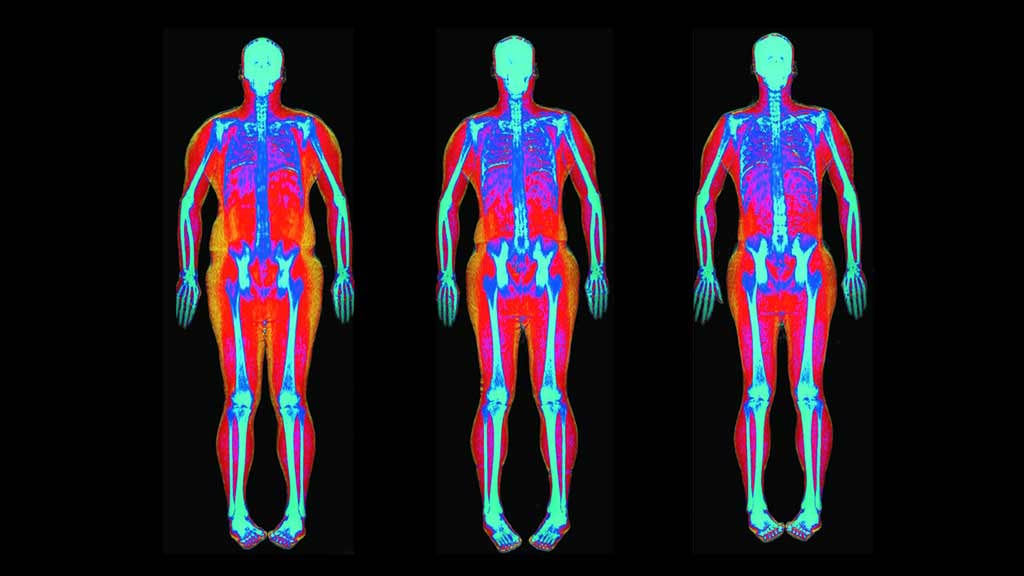 Measure your body fat percentage | Dubai Radiology Center
