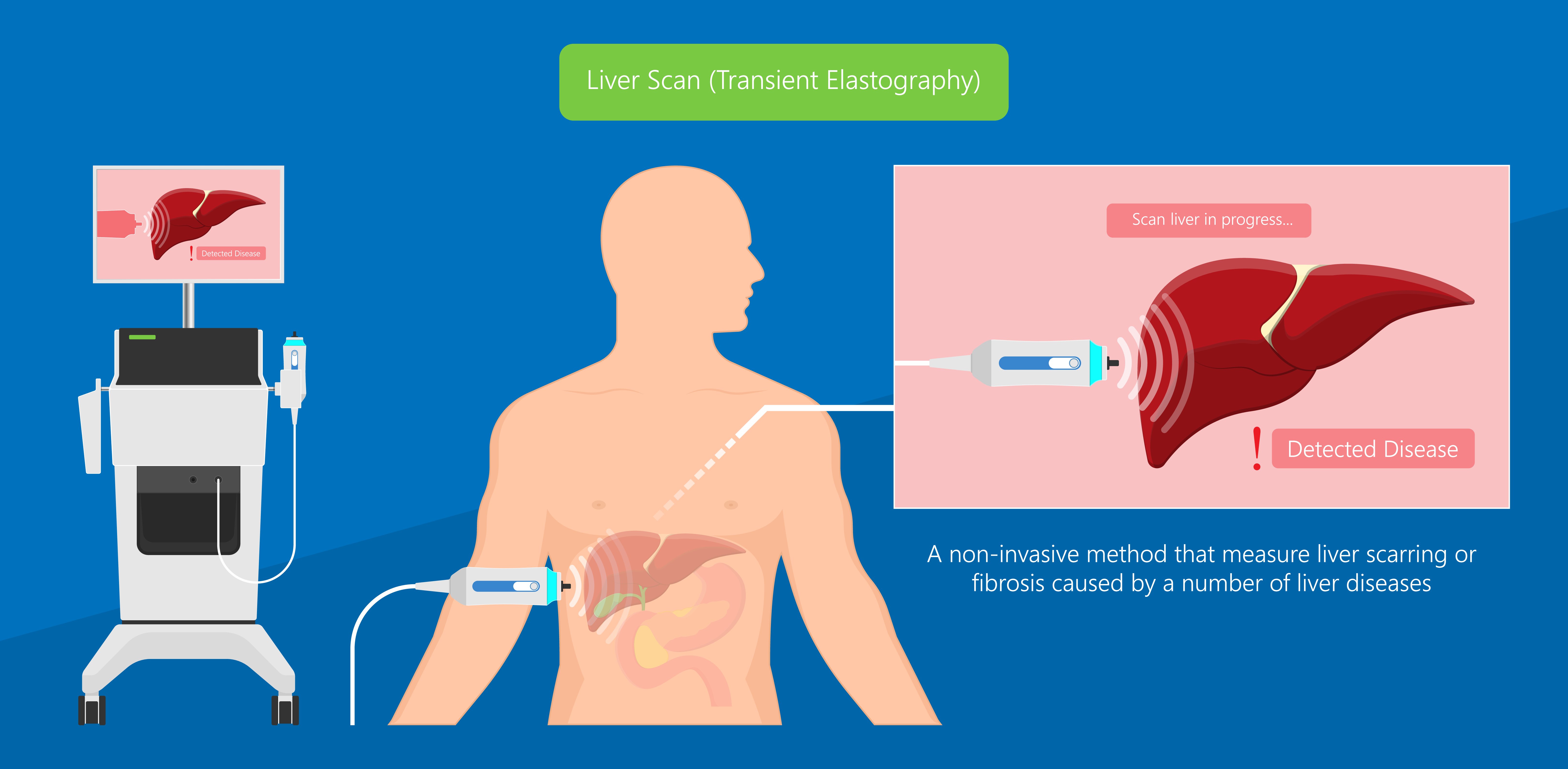 Cost of Liver Elastography Package | Dubai Gastroenterology Clinic