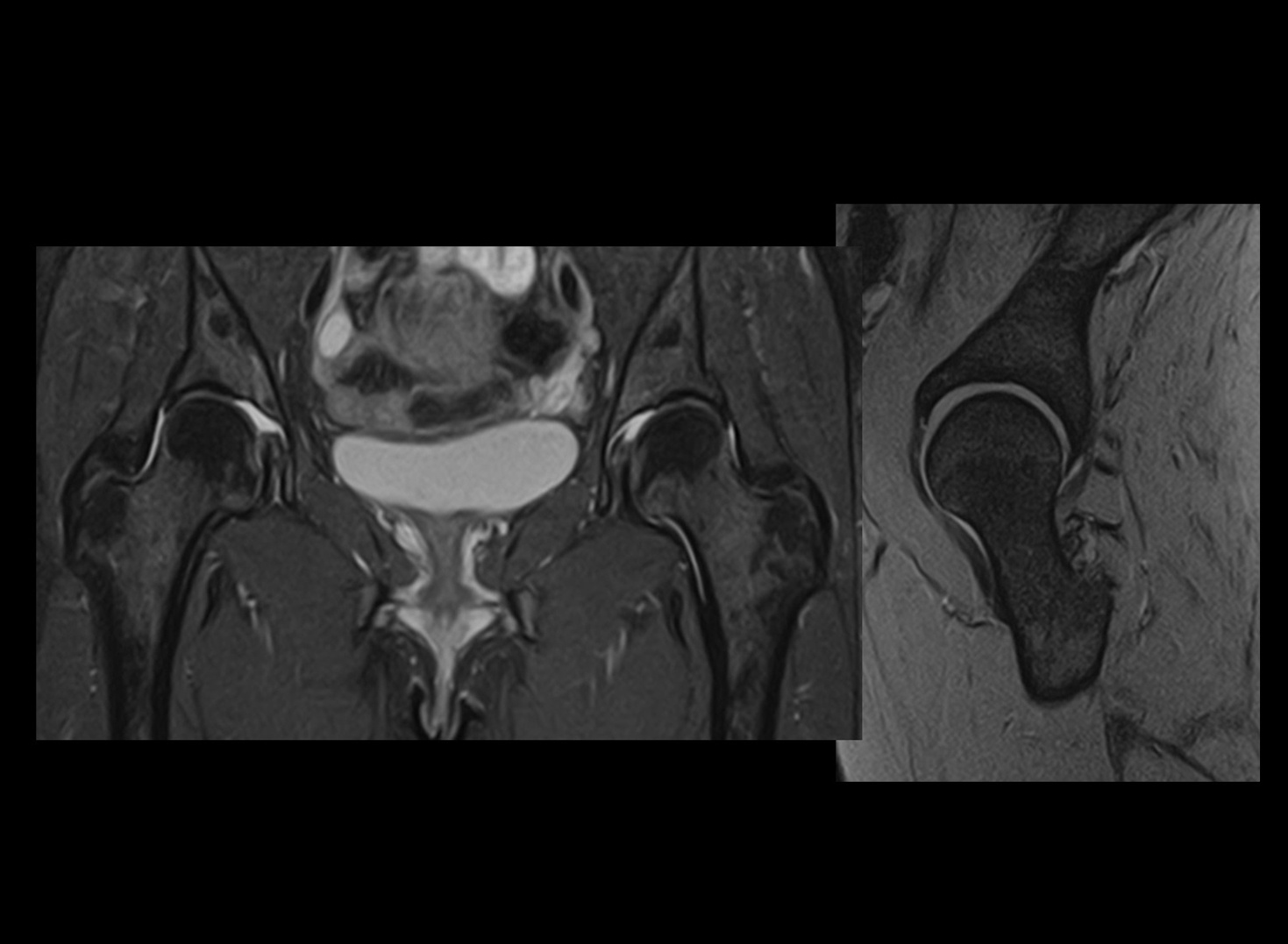 MRI Scan | Dubai Radiology Center | Same Day MRI