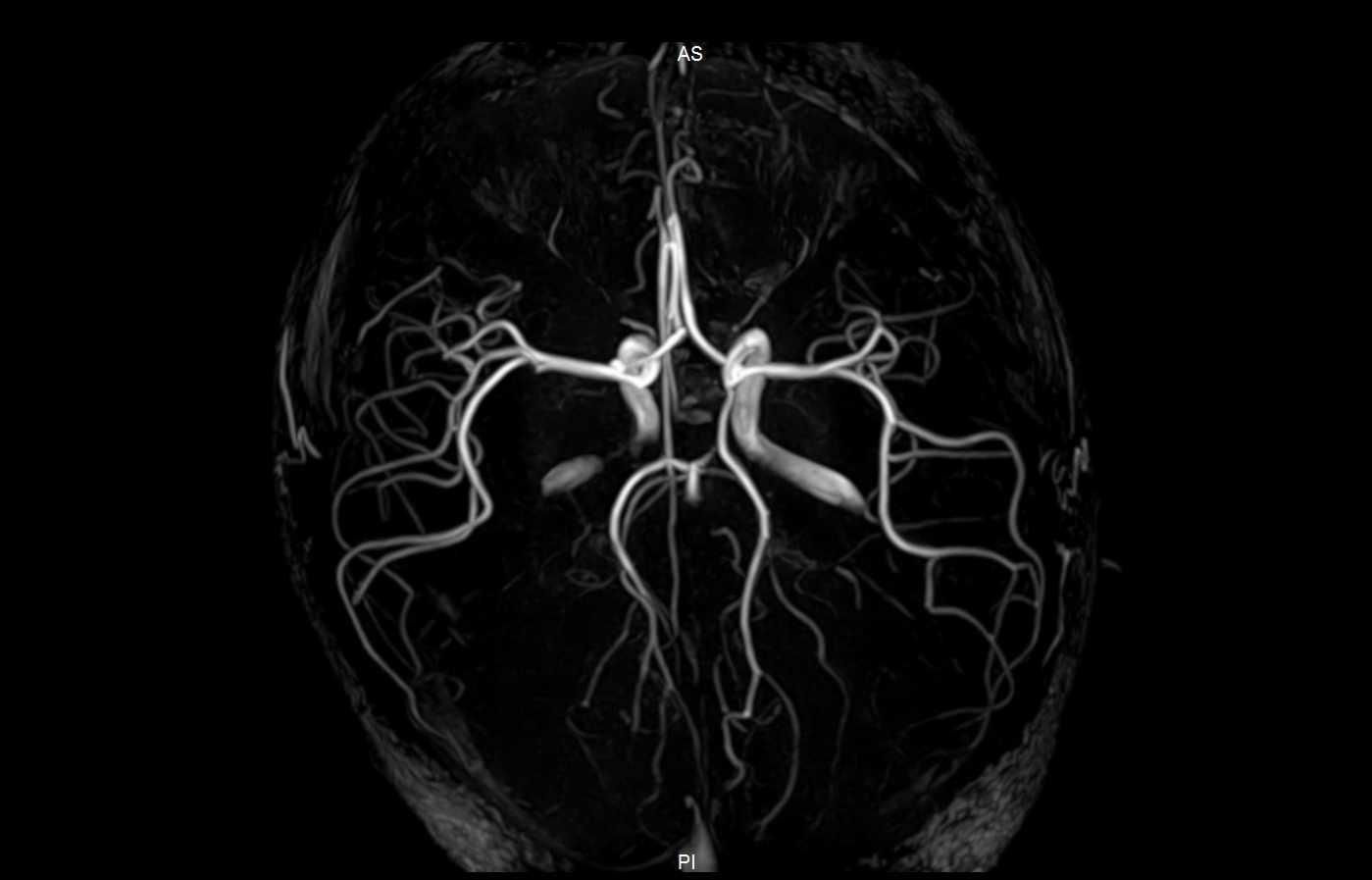 Dubai Neuro Radiology Center/ MRI-CT Scan