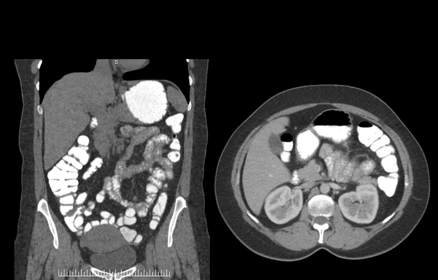 Dubai Radiology Center | CT scan