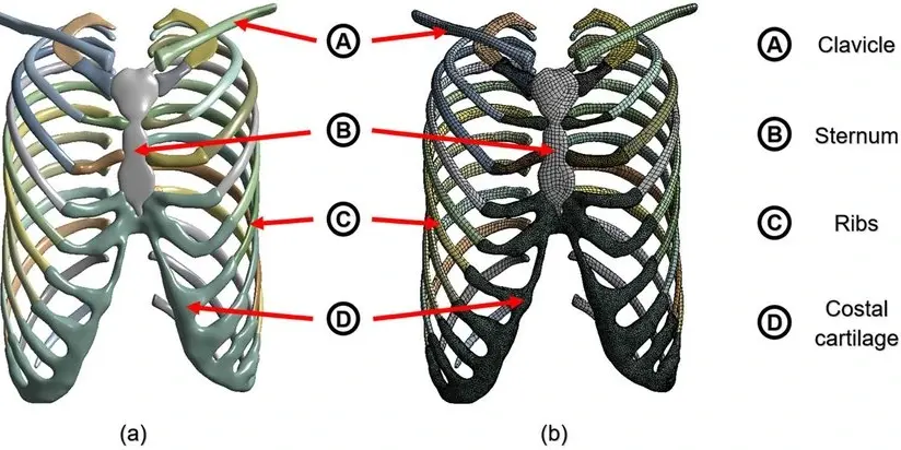 Ribs & Sternum Fixation Dubai | DRHC Thoracic Surgery Clinic